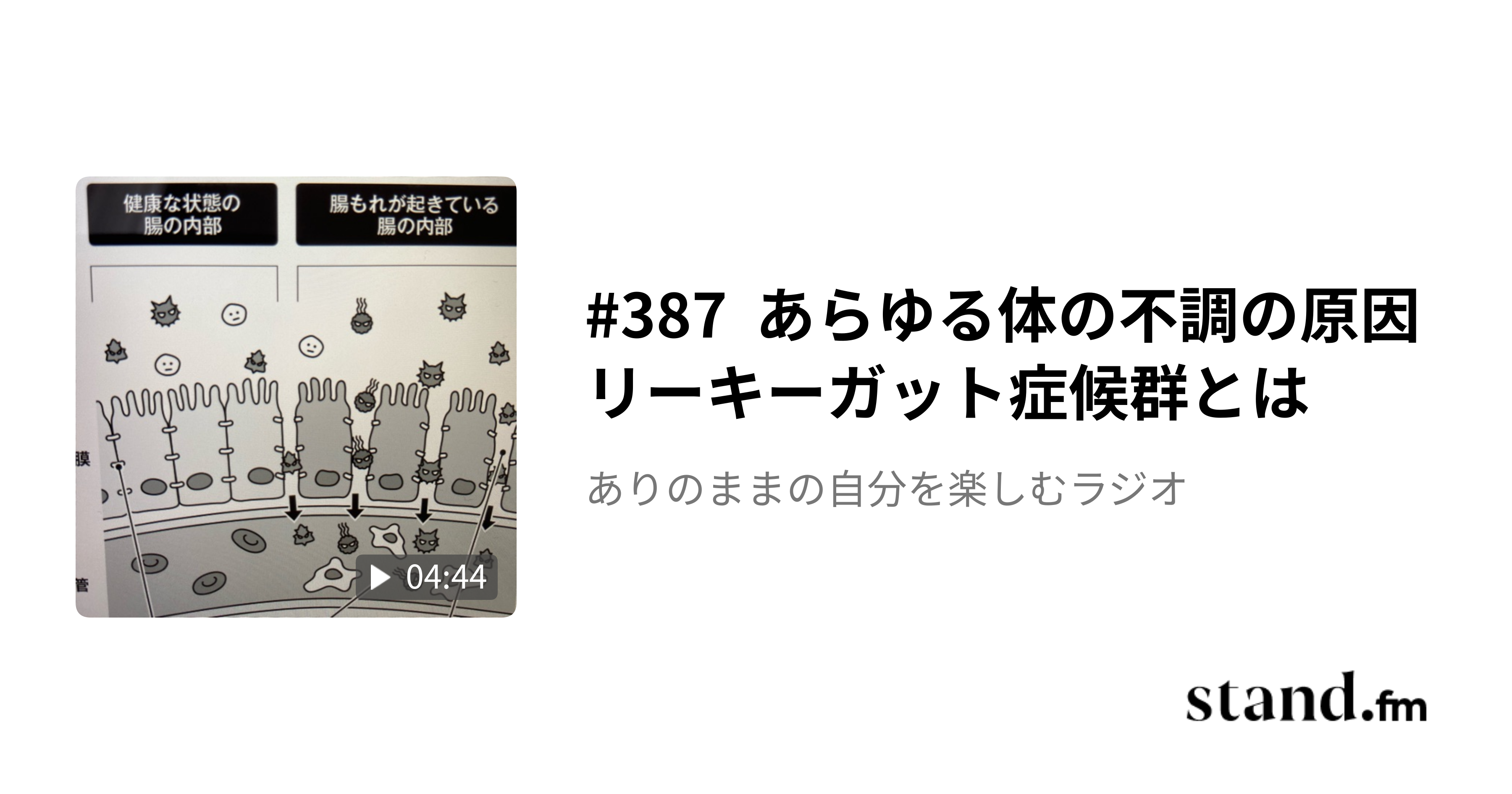 #387 あらゆる体の不調の原因リーキーガット症候群とは - ありのままの自分を楽しむラジオ | stand.fm